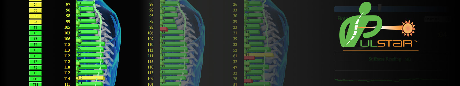 The history of chiropractic adjusting instruments
